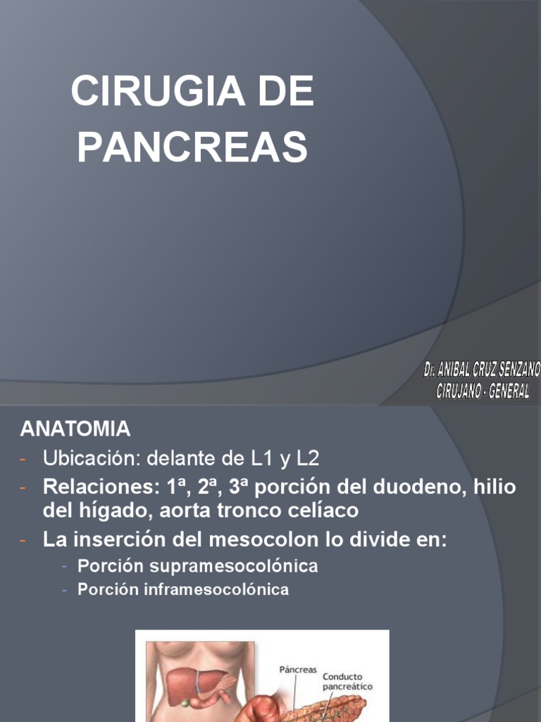 Cirugia de Pancreas | PDF | Páncreas | Estómago