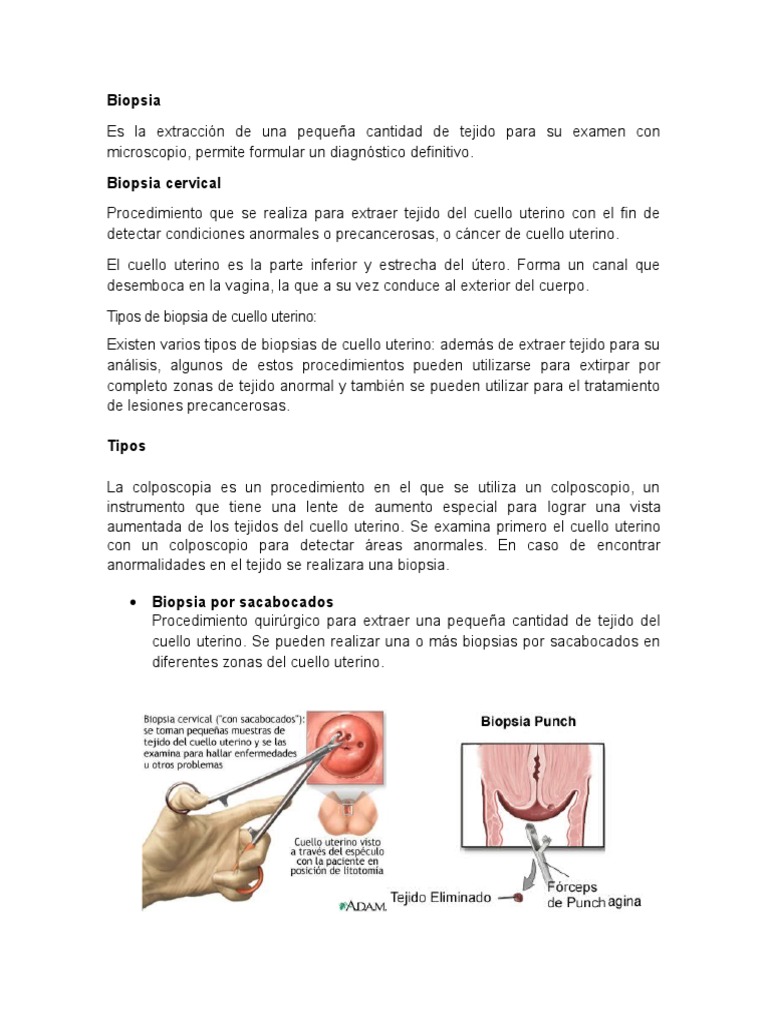 Biopsia de Cuello Uterino: Procedimientos y Resultados | PDF | Cáncer ...