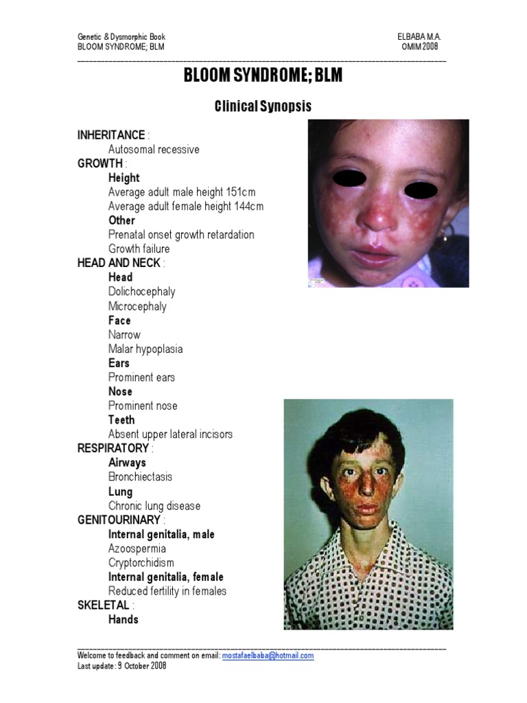 Bloom Syndrome | PDF