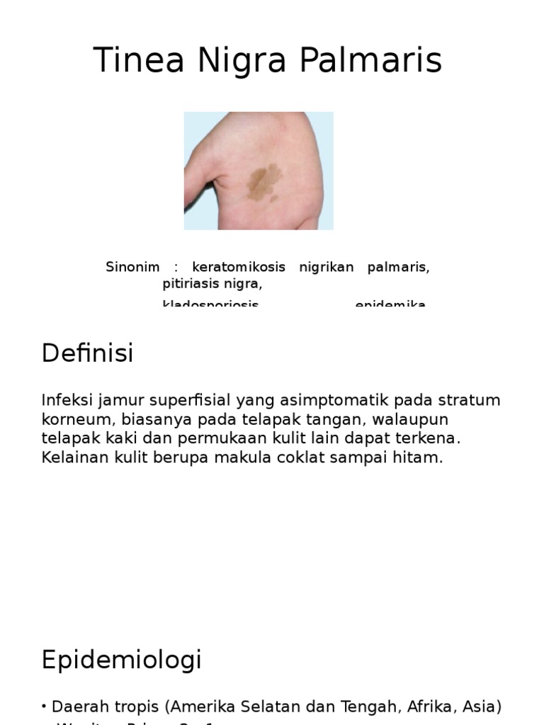 Tinea Nigra Palmaris | PDF