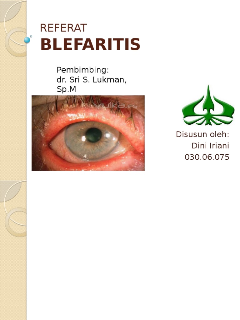 BLEFARITIS | PDF