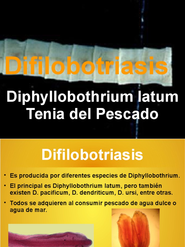 Diphyllobothrium Latum | PDF | Enfermedades y trastornos ...