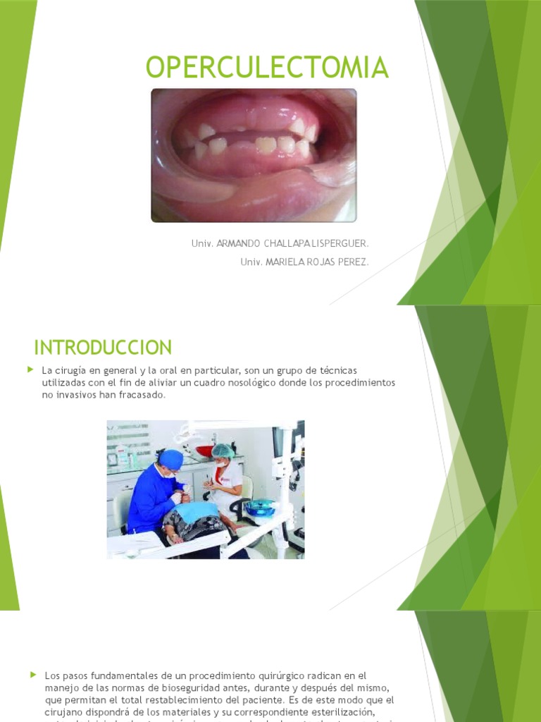 OPERCULECTOMIA | Diente humano | Cirugía