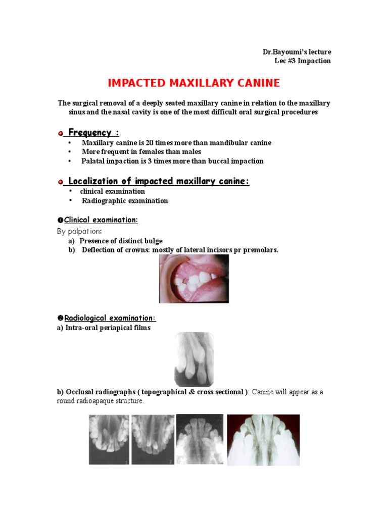 Impacted Maxillary Canine Surgical Exposure | PDF | Dental Anatomy ...