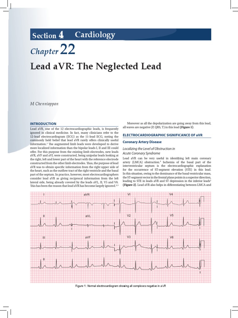 lead avr.pdf | Electrocardiography | Cardiovascular Diseases