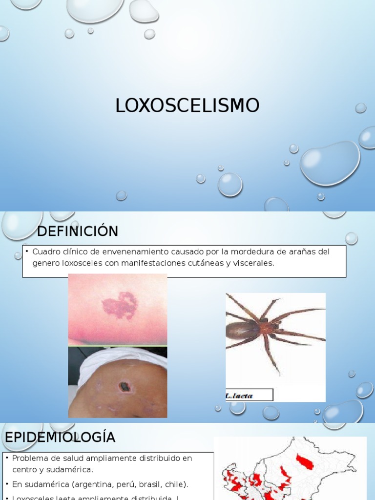 LOXOSCELISMO | Diseases And Disorders | Medical Specialties
