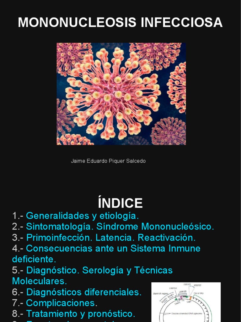 Presentación. Mononucleosis Infecciosa | Virus | Ciencias de la Salud