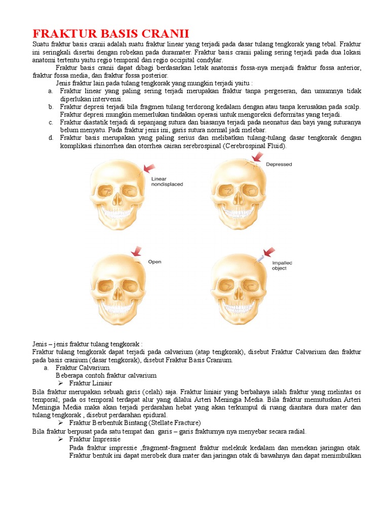 Fraktur Basis Cranii | PDF