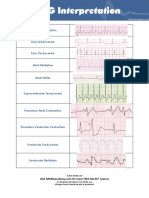Ecg MCQS | PDF | Electrocardiography | Cardiology