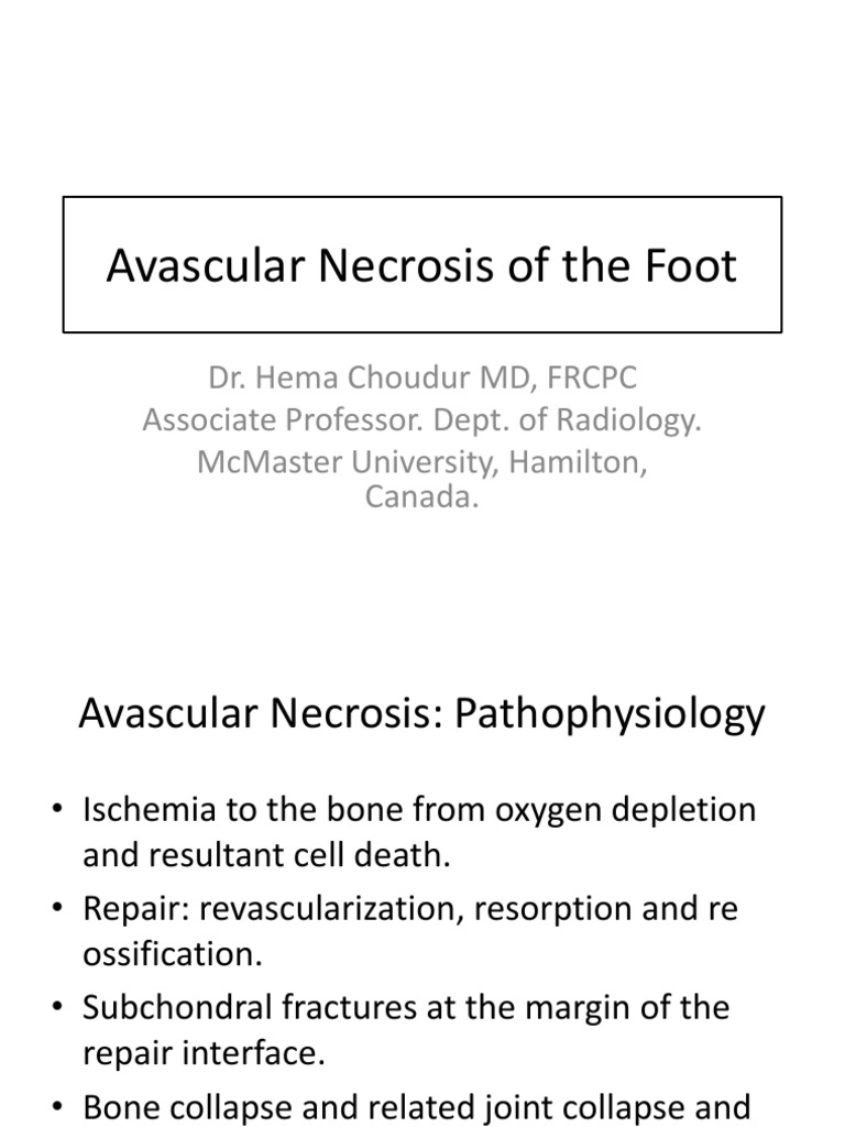 Avascular Necrosis of The Foot | PDF | Blood Vessel | Bone