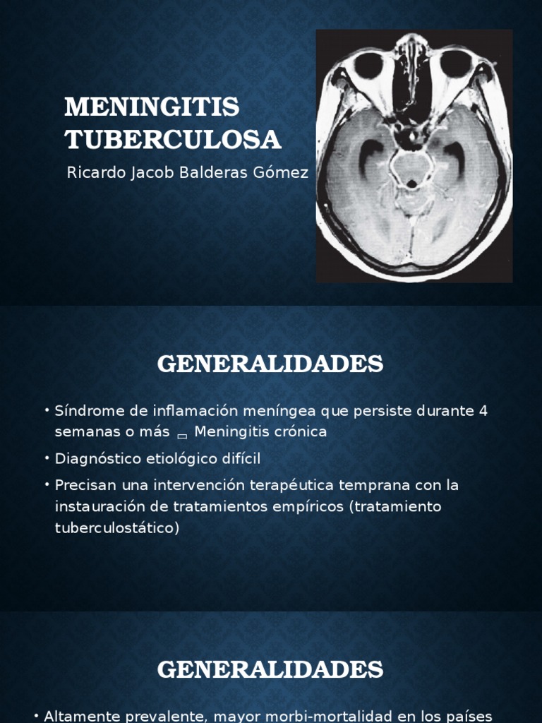 Meningitis Tb | Tuberculosis | Meningitis