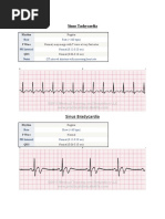 Basic Arrhythmia Rules | PDF | Electrocardiography | Physiology
