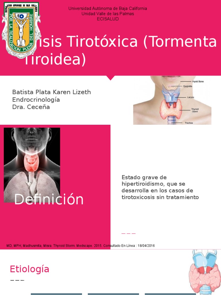 Tormenta Tiroidea | Hipertiroidismo | Órgano (Anatomía)