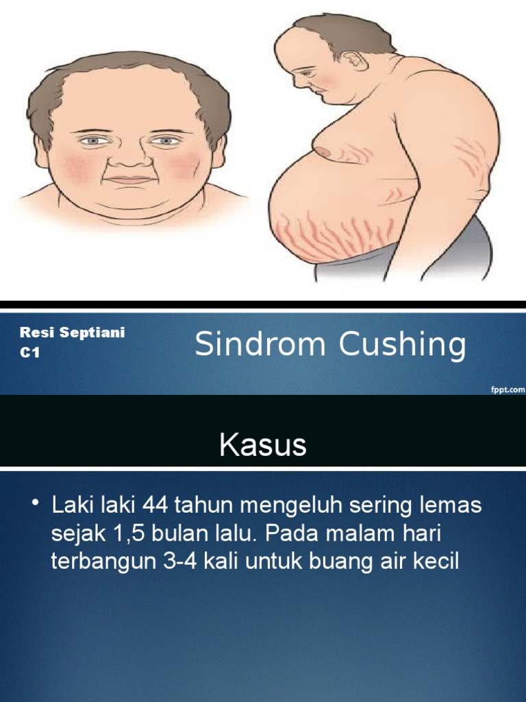 Sindrom Cushing | PDF