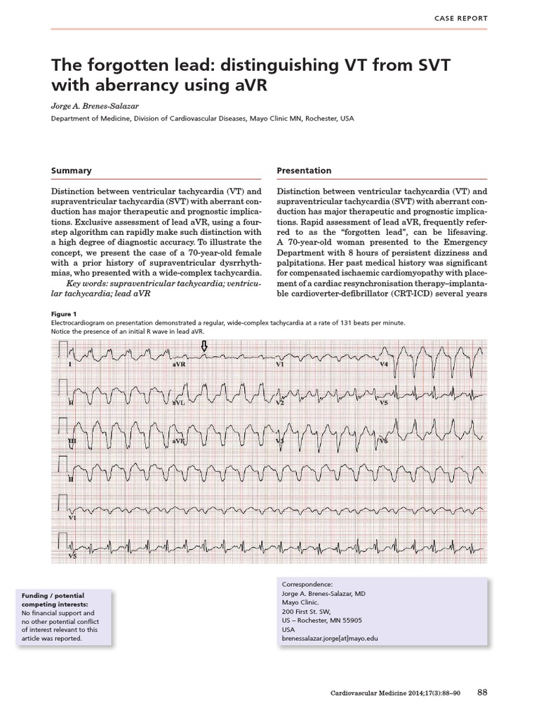 VT SVT Avr | Download Free PDF | Electrocardiography | Cardiovascular ...