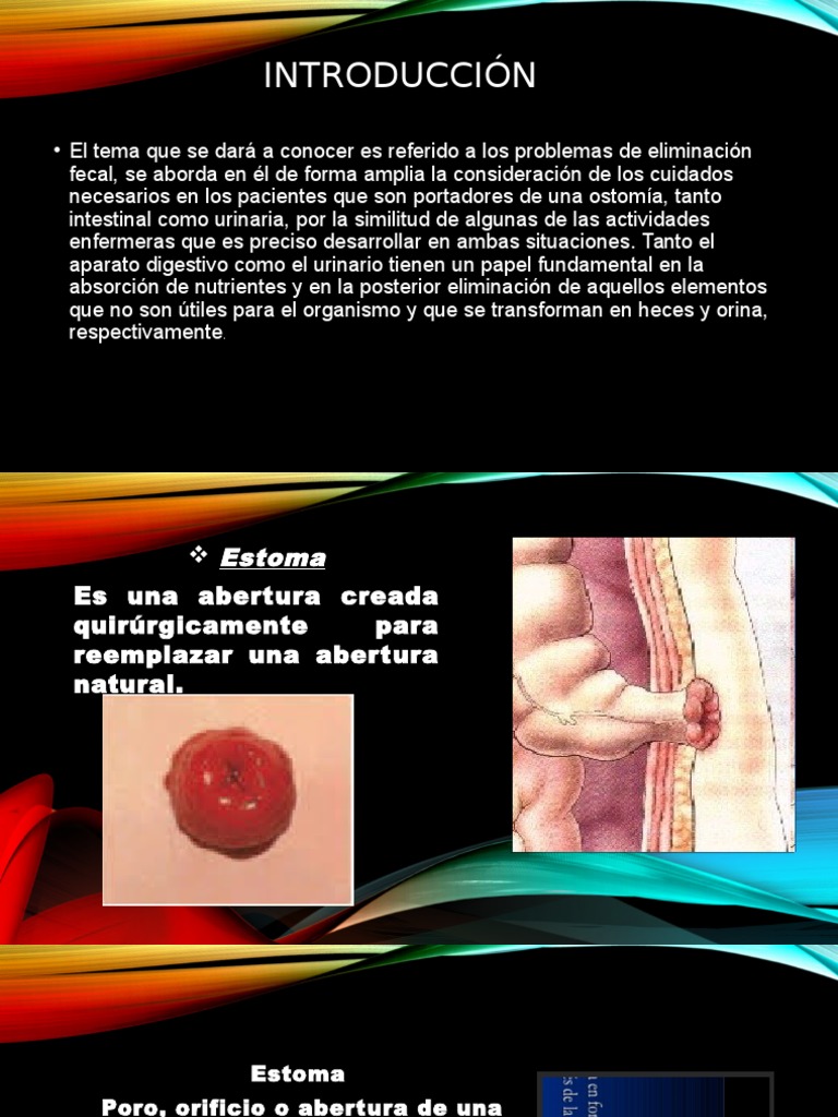Estomas | Gastroenterología | Medicina