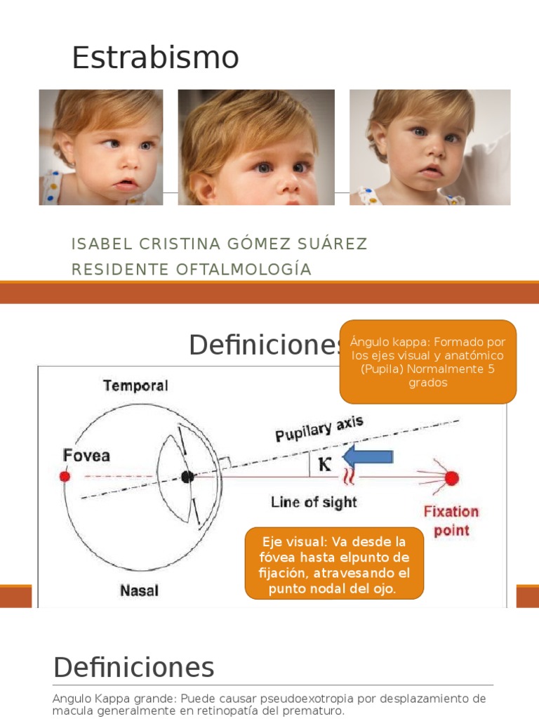 Estrabismo | Percepción visual | Visión