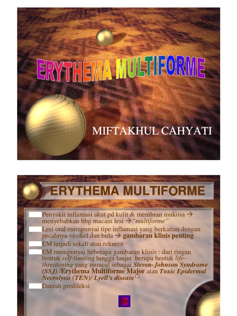 Erythema Multiforme | PDF