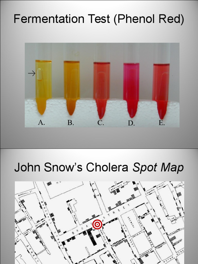 Fermentation Test (Phenol Red) | PDF | Sewage Treatment | Anaerobic ...