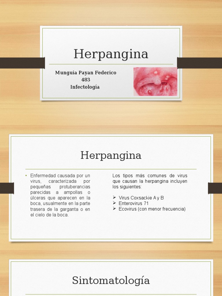 Herpangina: Causas y Síntomas | PDF | Cocina, comidas y vino | Ciencia ...