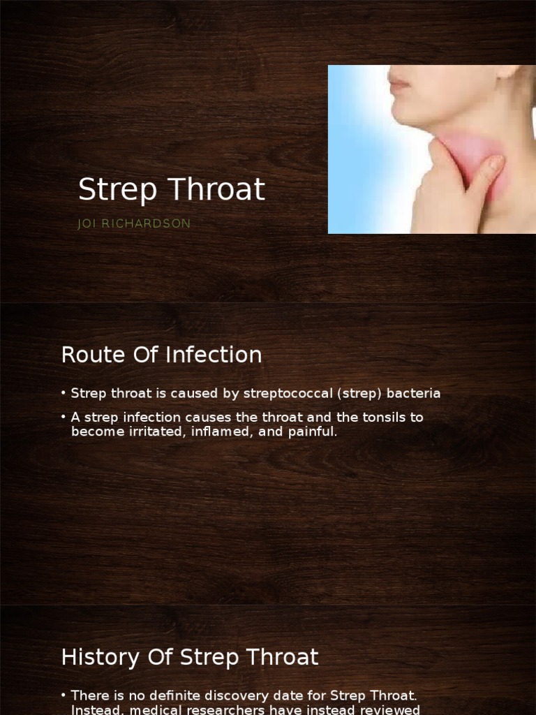 Understanding Strep Throat Causes History Transmission And