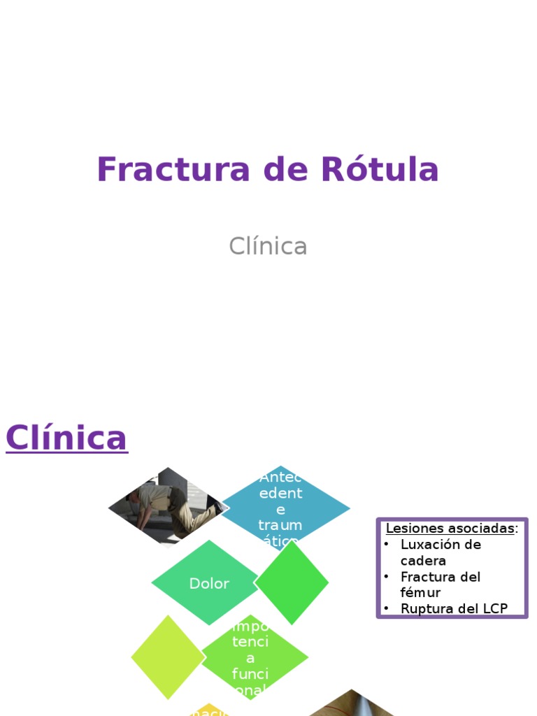 Fractura de Rótula: Diagnóstico y Tratamiento | PDF | Rodilla ...
