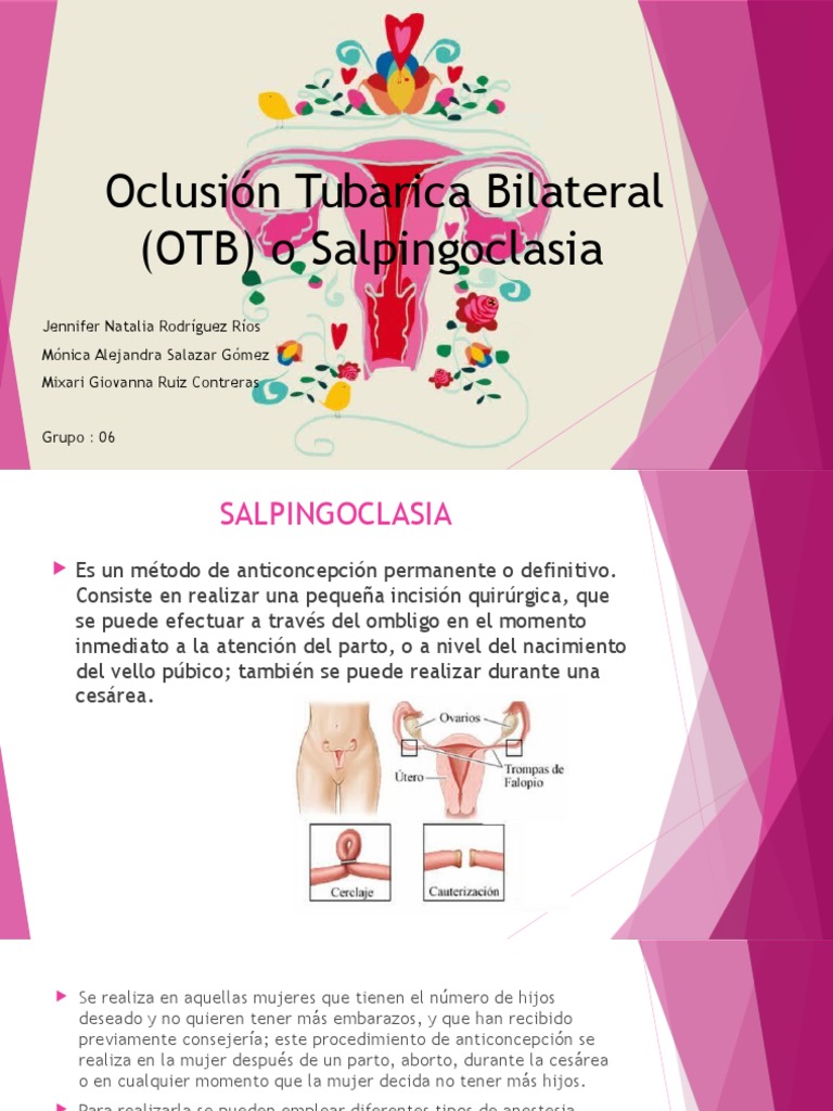 Oclusión Tubárica Bilateral: Efectividad y Ventajas | PDF