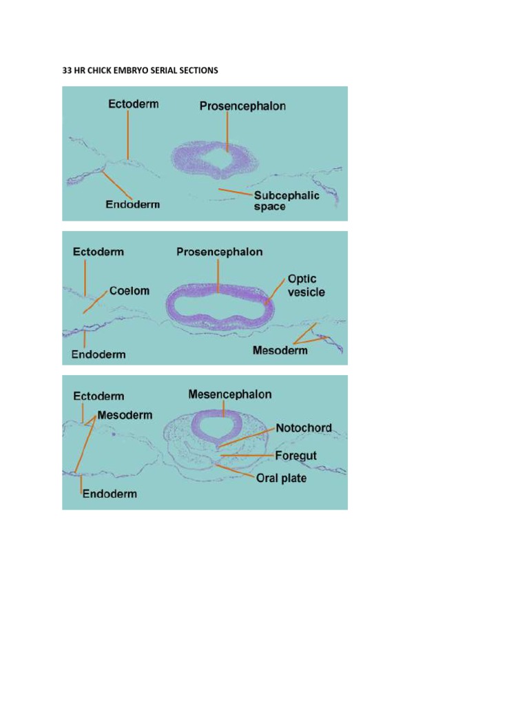 33 Hr Chick Embryo Serial Sections