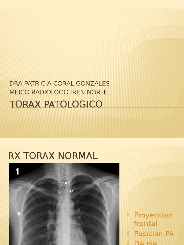 Torax Patologico Upao | PDF | Pulmón | Tórax