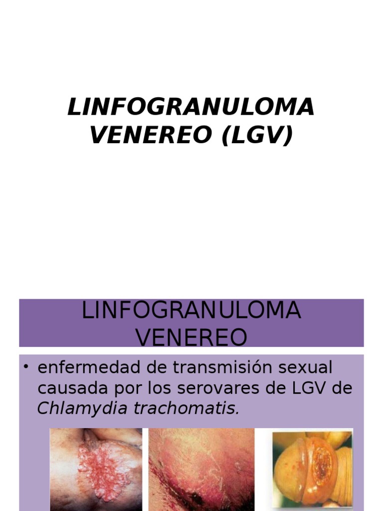 Linfogranuloma Venereo (LGV) | PDF | Inflamación | Infección