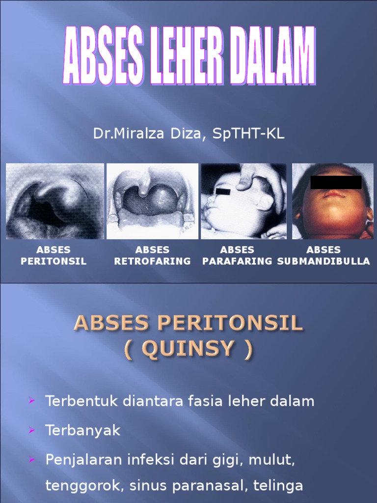 Abses dan Infeksi di Daerah Kepala dan Leher | PDF