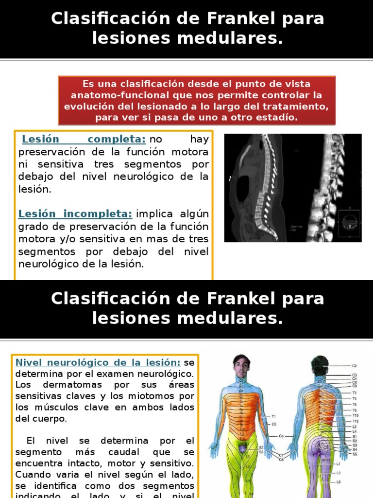 Clasificación de Frankel en Lesiones Medulares | PDF | Lesión de la ...