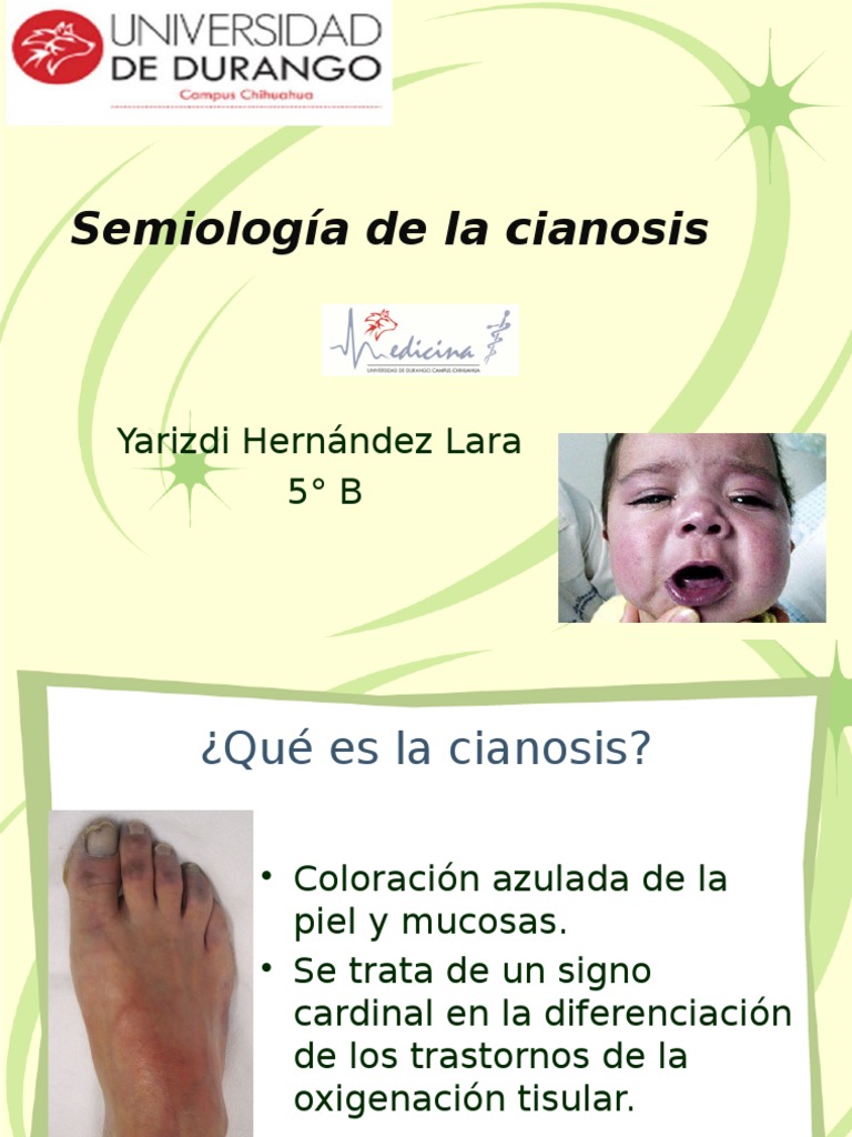 Semiología de La Cianosis | PDF | Defecto cardiaco congenito | Sistema ...