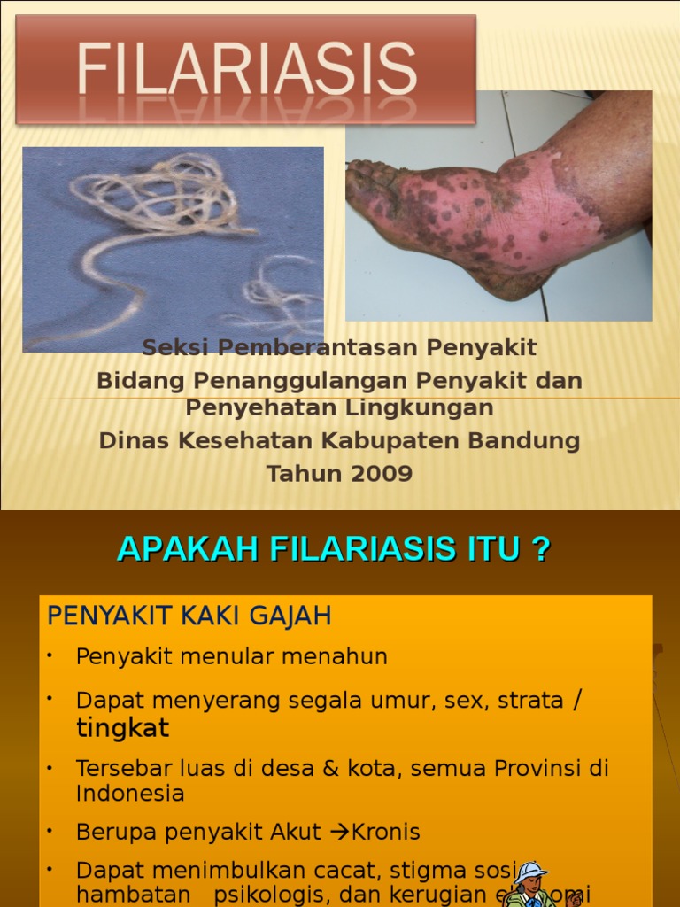 Filariasis | PDF