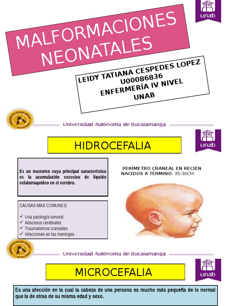 Malformaciones Neonatales 1 | PDF | Especialidades Medicas | Enfermedades y trastornos