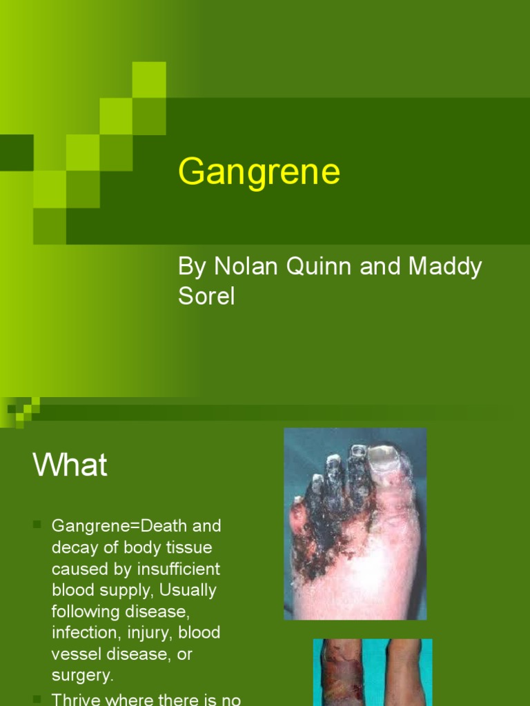 Gangrene.ppt | Medical Specialties | Clinical Medicine
