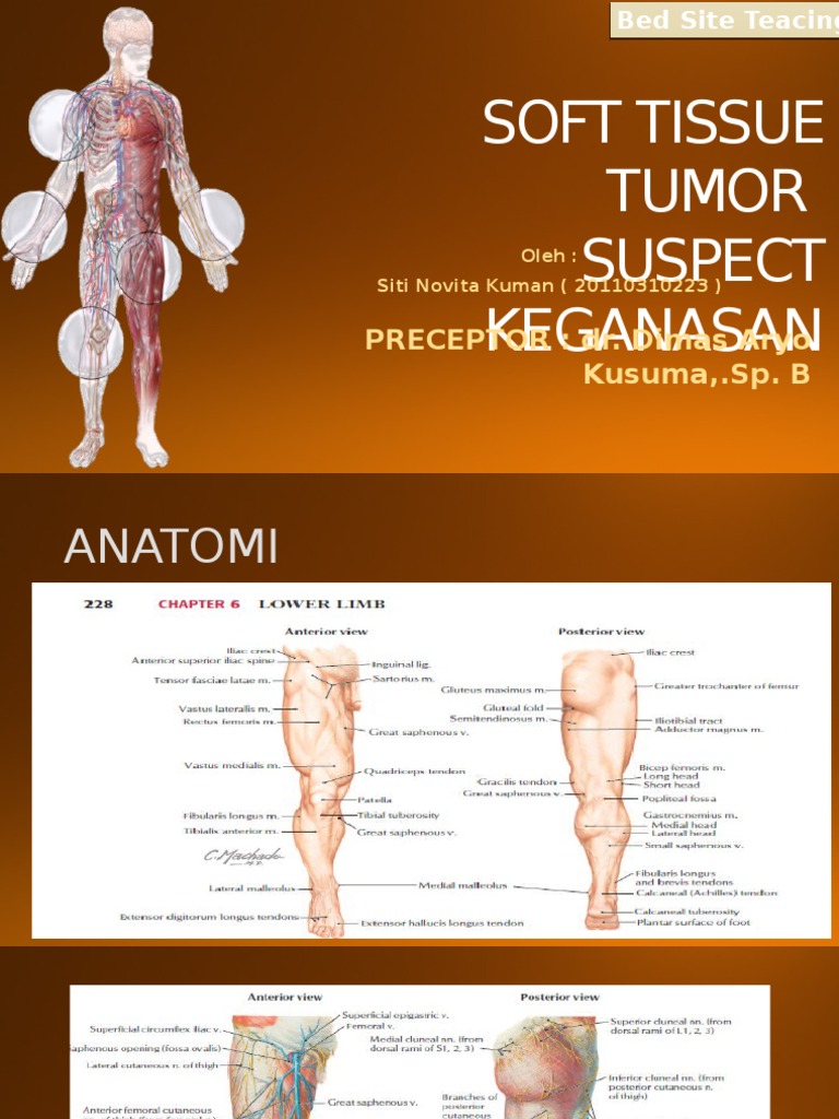 Soft Tissue Tumor | PDF | Kesehatan Holistik | Sains & Matematika
