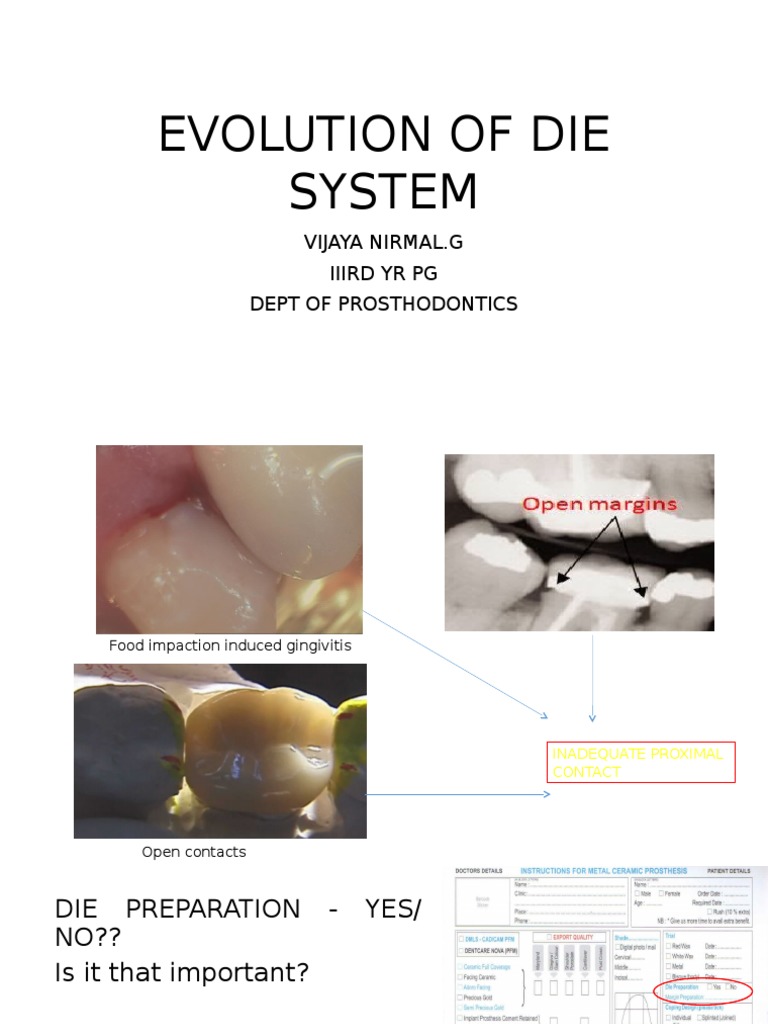 Evolution of Die System | PDF