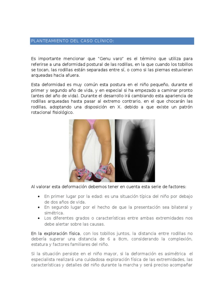 Genu Varo y Raquitismo Hipofosfatémico | PDF | Vitamina D | Rodilla