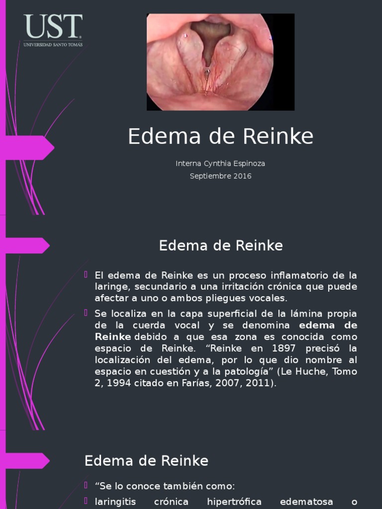 Edema de Reinke: Causas y Tratamiento | PDF | Ciencia y matemáticas