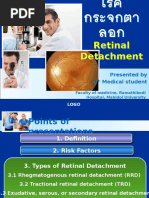 Understanding White Without Pressure (WWOP) | PDF | Vision | Ophthalmology