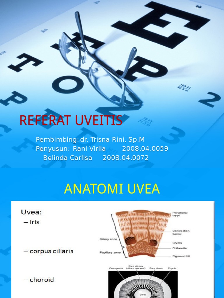 Referat Uveitis | PDF
