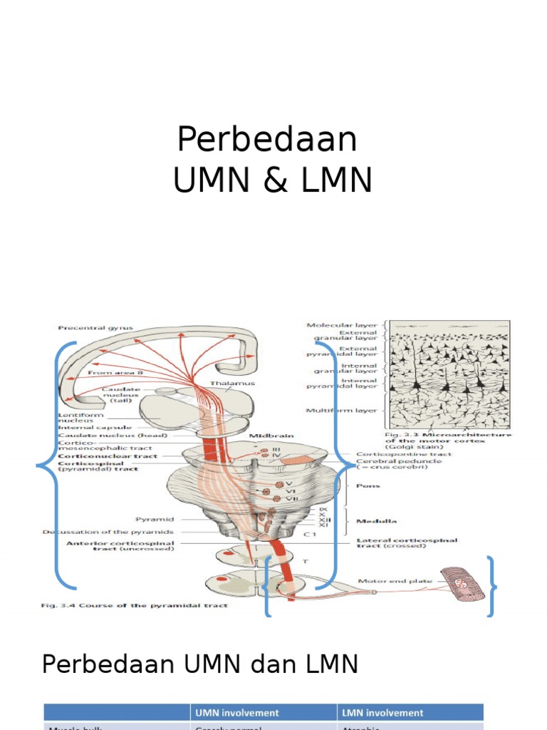 Perbedaan UMN LMN | PDF