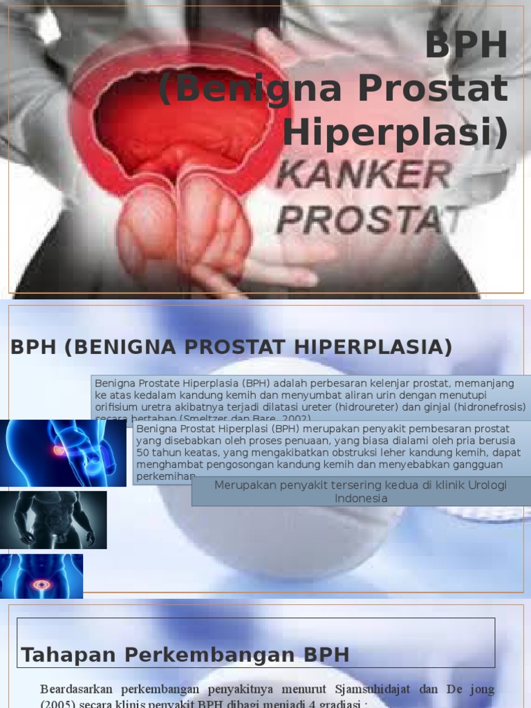 BPH (Benigna Prostat Hiperplasia) | PDF