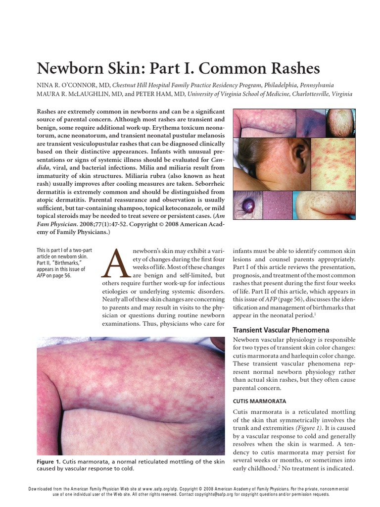 Neonatal Rashes PDF | PDF | Dermatitis | Cutaneous Conditions