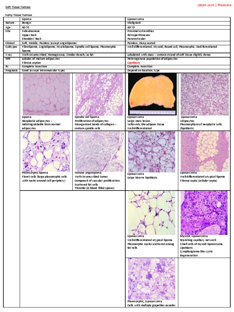 Soft Tissue Tumours | PDF | Neoplasms | Benign Tumor