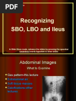 Care Plan Small Bowel Obstruction | PDF | Nausea | Gastroenterology