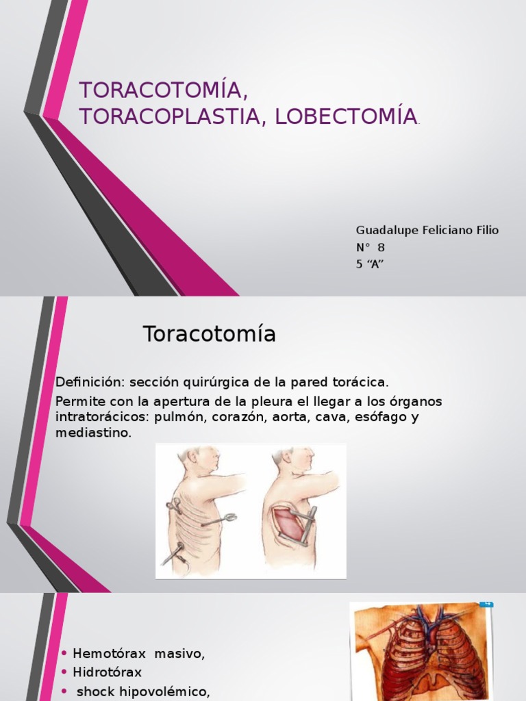TORACOTOMÍA, TORACOPLASTIA, LOBECTOMÍA | Pulmón | Especialidades Medicas