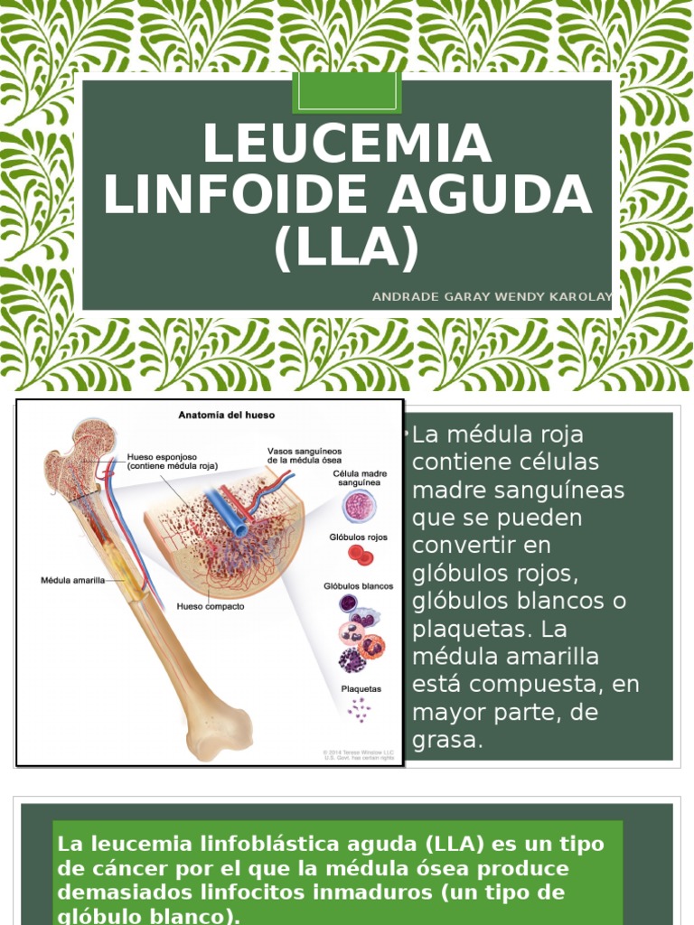 Leucemia Linfoblástica Aguda: Diagnóstico y Tratamiento | PDF ...