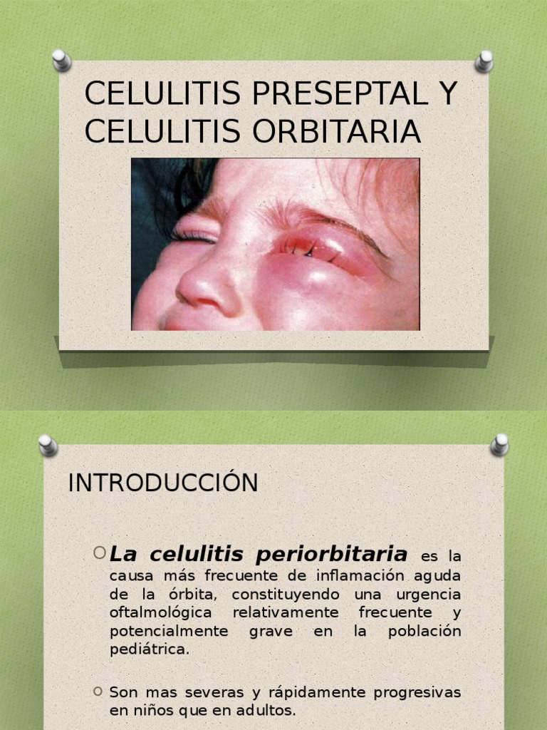 Celulitis Preseptal y Celulitis Orbitaria | PDF | Rtt | Microbiología